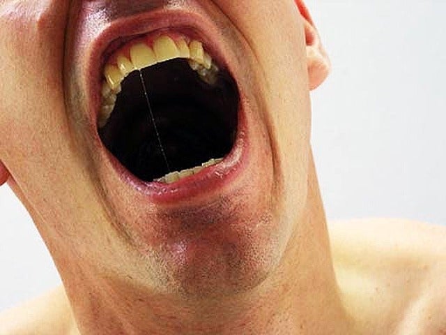 Bipolar disorder: 10 subtle signs