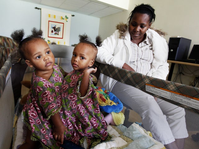 Conjoined twins Maria & Teresa Tapia: Before and after