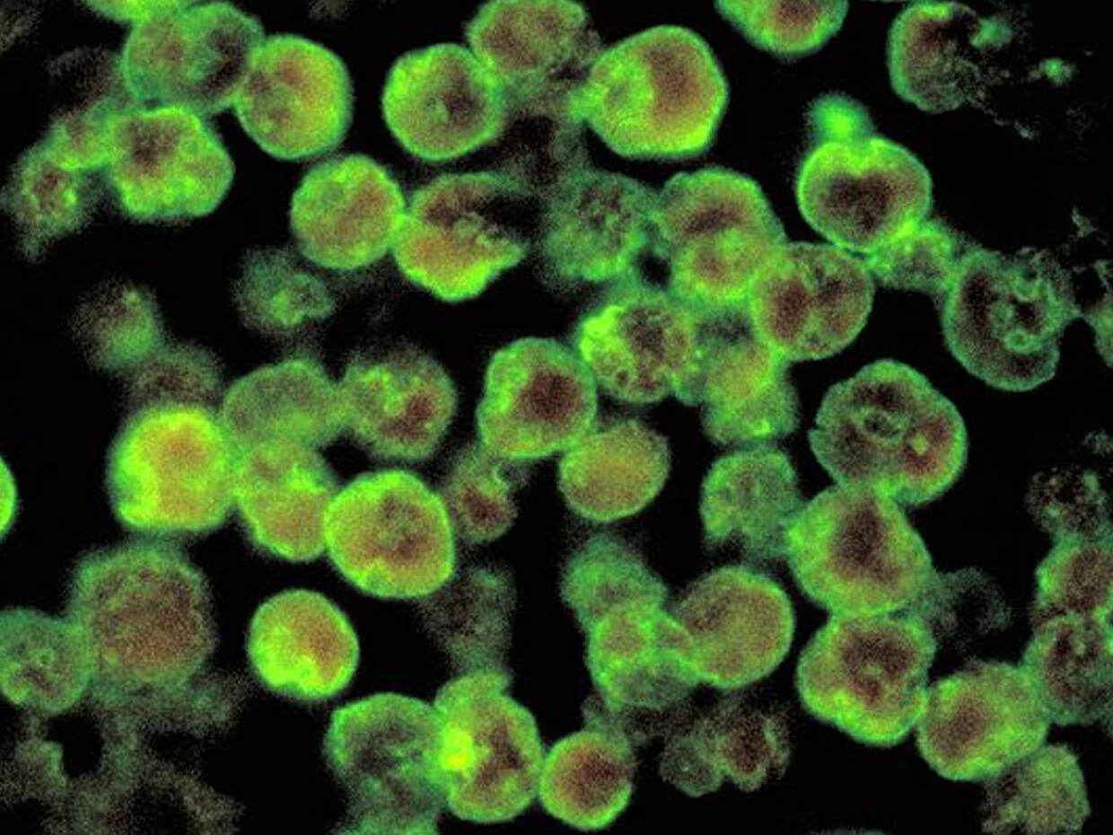 Brain-eating amoeba detected in La. water system - CBS News