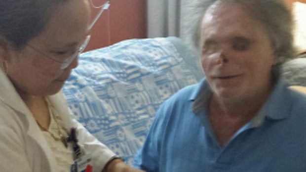 Ronald Poppo, South Florida man who suffered cannibalistic attack one ...