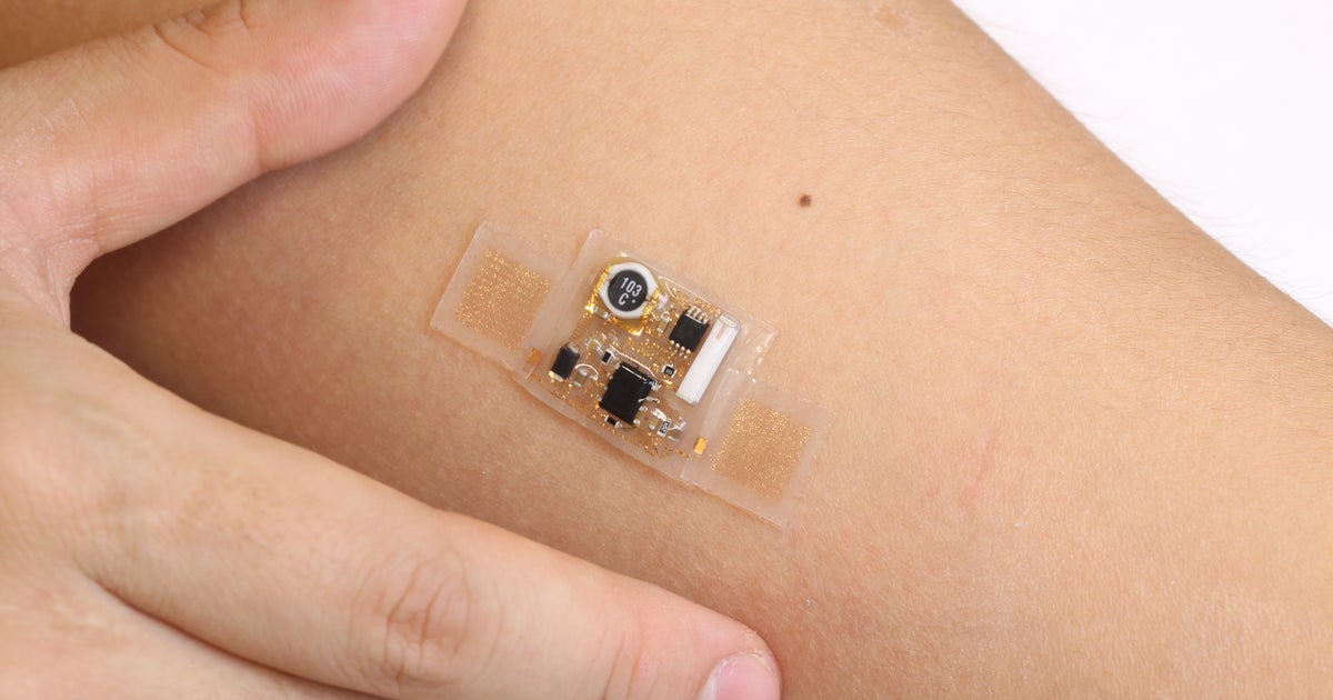 Tiny biosensor patches worn on skin show big promise - CBS News