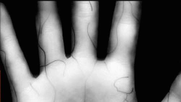 Global Innovations: Health - CBS News