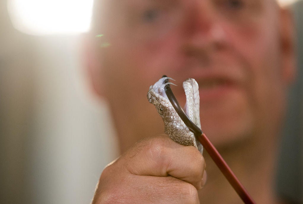 Insane snake attacks (WARNING: GRAPHIC IMAGES)