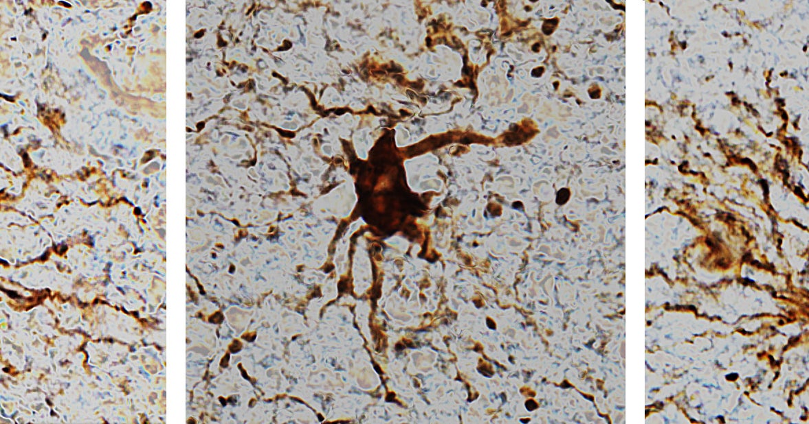 'Zombie Genes'? UIC Researchers Find Some Brain Cells Increase Activity ...