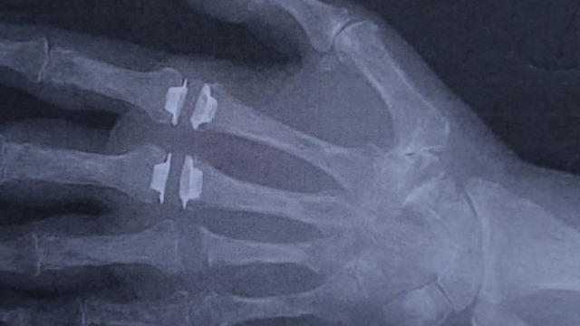 Stories About R Kelly - CBS News